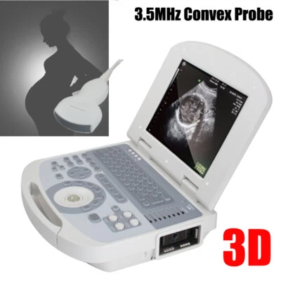 Best 3d Ultrasound Deals | Dealsan