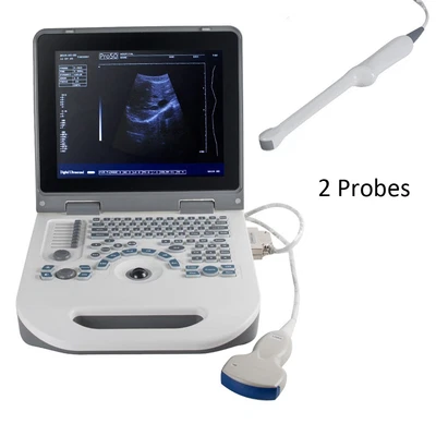 Best 3d Ultrasound Deals | Dealsan