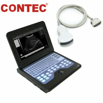 Portable Ultrasound Machine Deals ⇒ Best Sales in UK | Dealsan